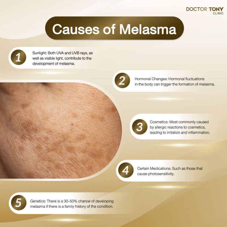 Melasma Dissolving Injection