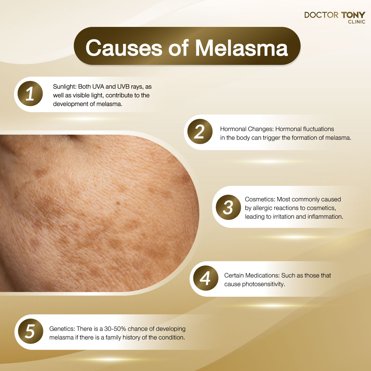 Melasma Dissolving Injection