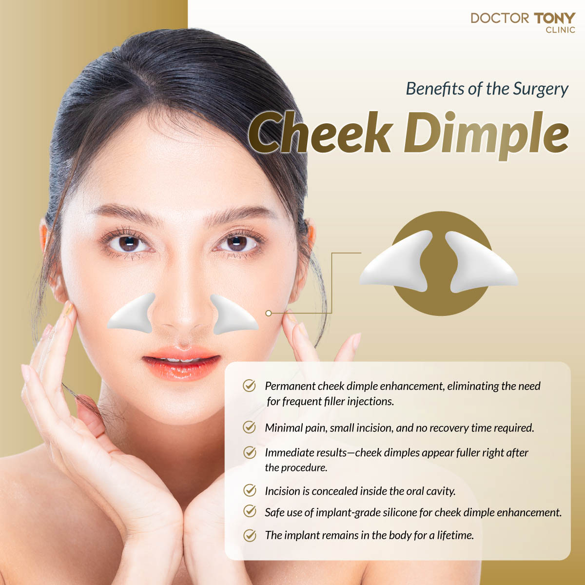 Cheek Dimple Enhancement | Silicone Implant