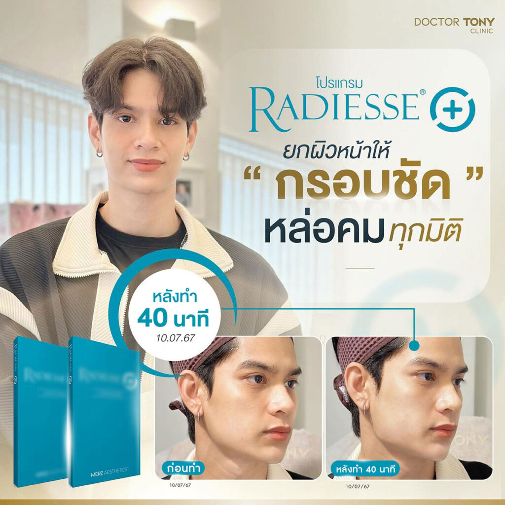 Radiesse plus ยกกระชับ ปรับกรอบหน้า Doctor Tony Clinic