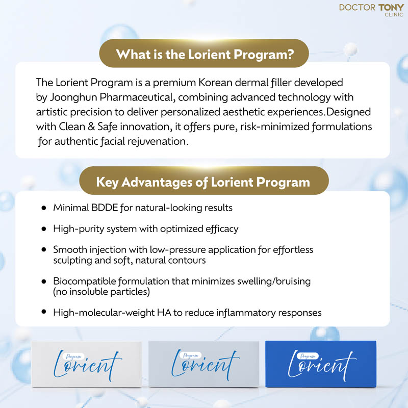 What is Lorient Filler ? How many variants are available? - Doctor Tony ...